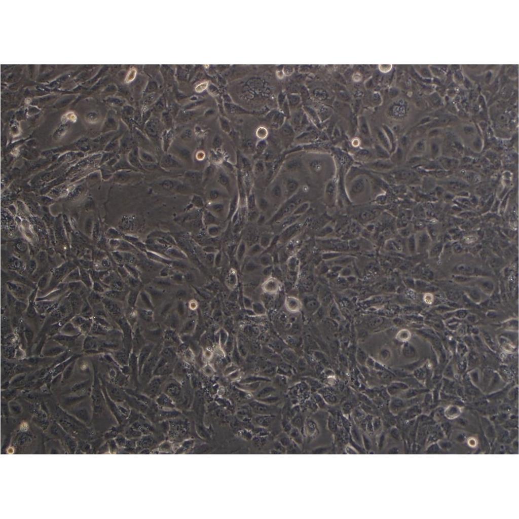 OCUT-2C Cells人甲状腺癌贴壁细胞系 (赠送STR基因图谱) 品牌:ATCC、DSMZ等 美国、欧洲、德国等 - ChemicalBook