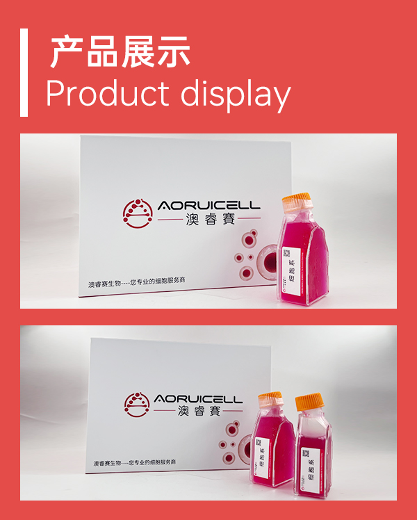 HGC-27-LUC（人胃癌细胞稳定表达荧光素酶） 品牌:澳睿赛生物 上海 - ChemicalBook